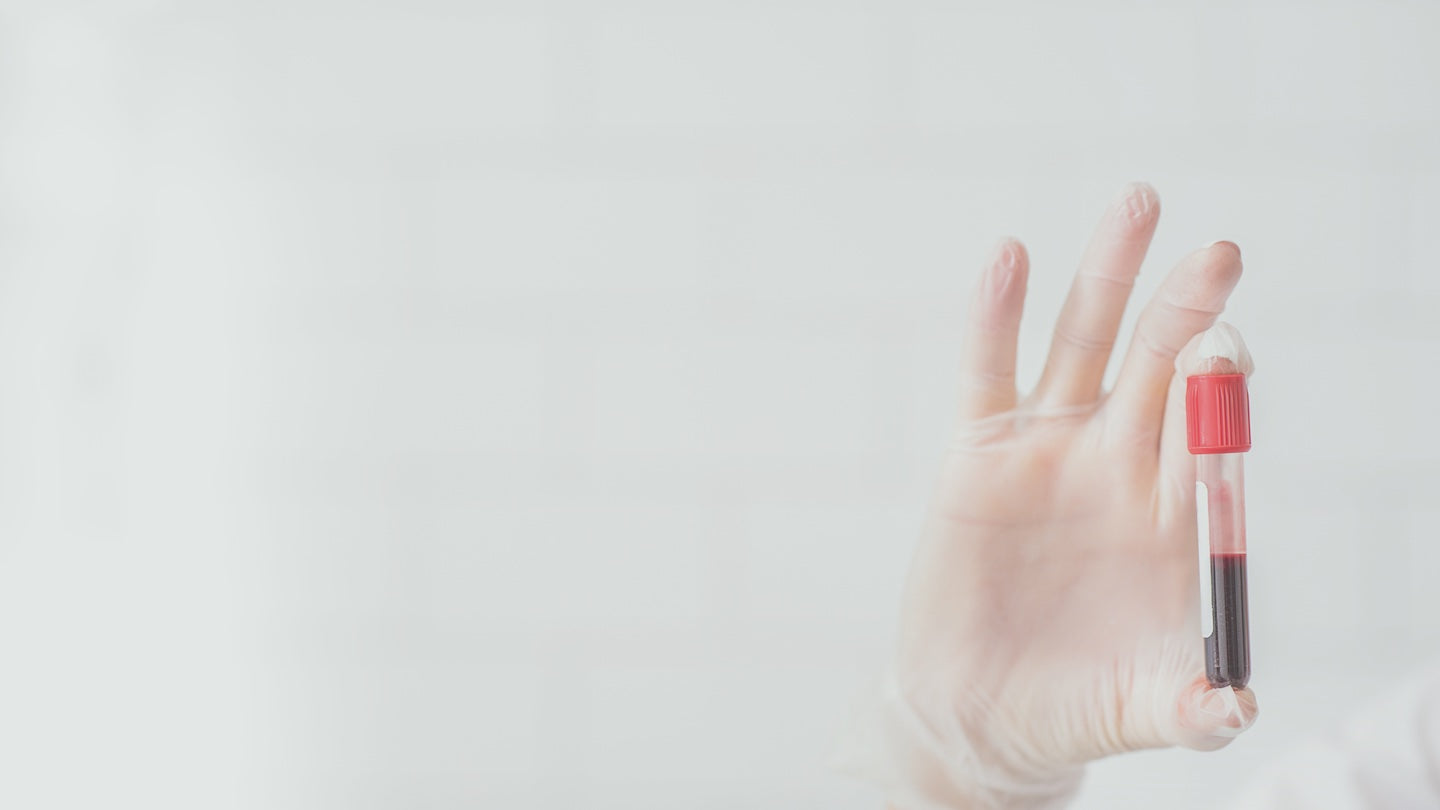 Das Anti-Müller-Hormon und die Bedeutung bei Kinderwunsch